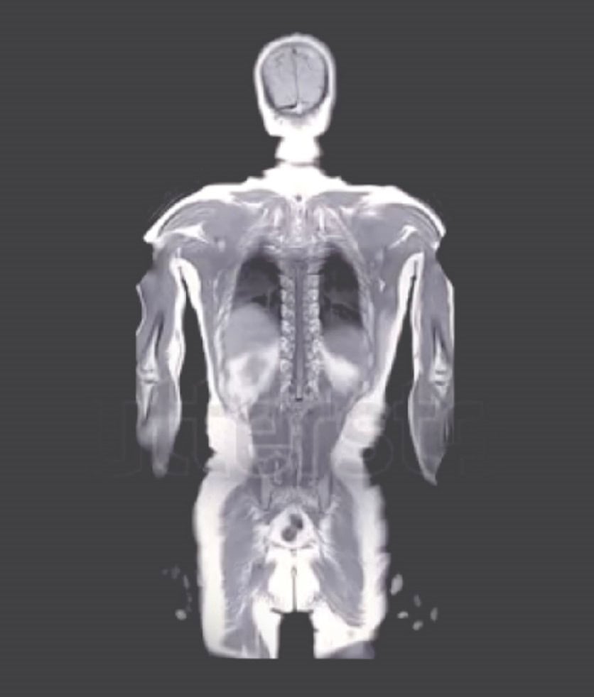 MRI Wellness Full Body MRI Scan In Charleston No Referral Needed