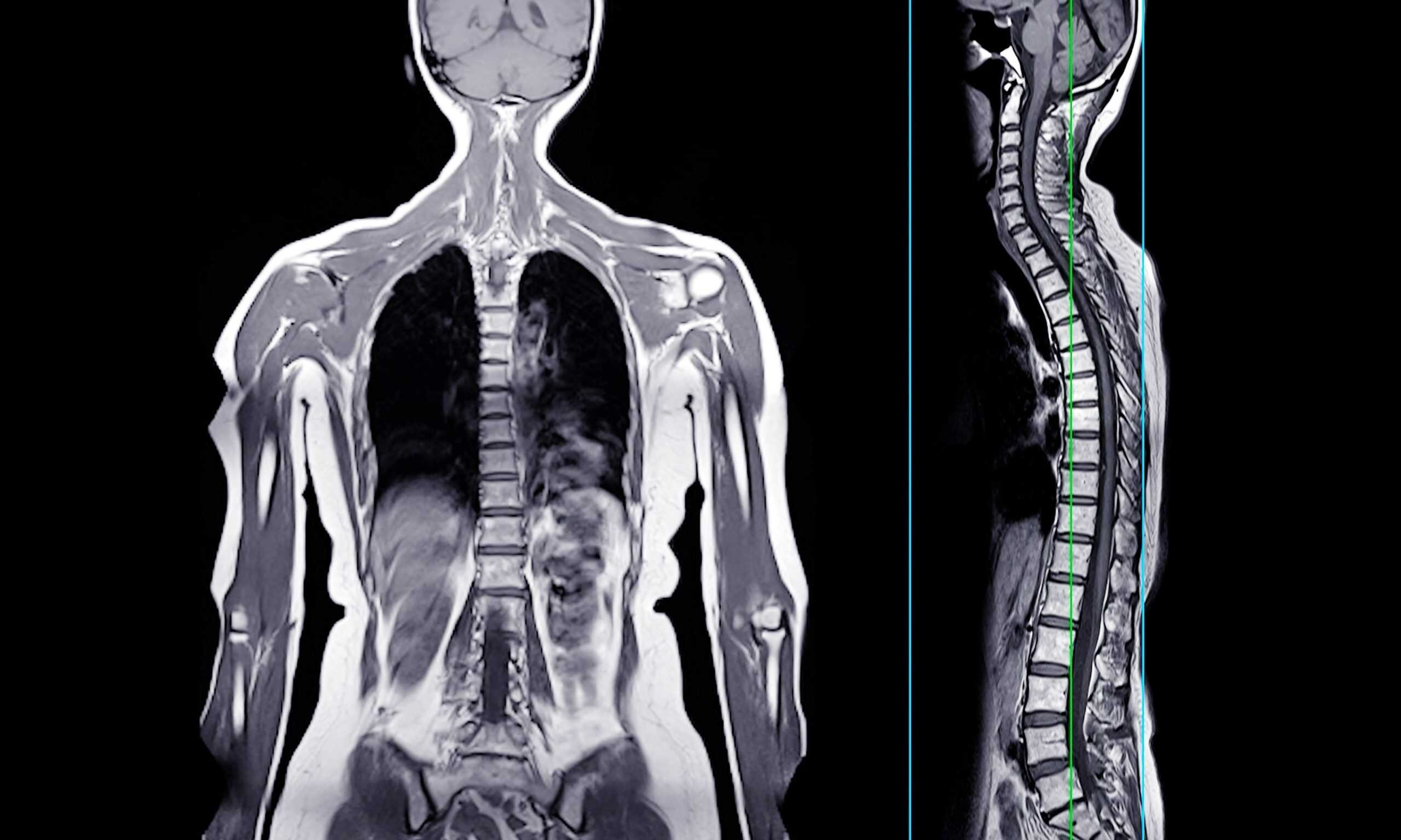 From Prep to Results: Whole Body MRI Scan Questions Answered - March 2026